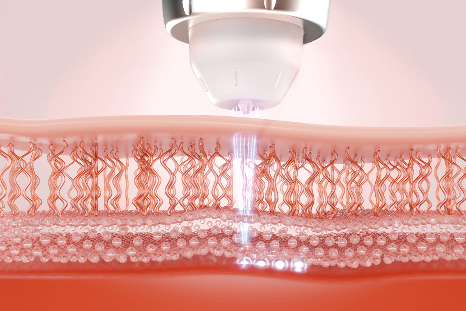 3Dトータルケアマシン LIF Shock | リフショック | 業務用脱毛機・ 美容機器の販売・レンタルは株式会社レイリーチ