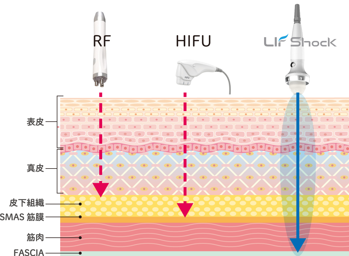 3Dトータルケアマシン LIF Shock | リフショック | 業務用脱毛機・ 美容機器の販売・レンタルは株式会社レイリーチ